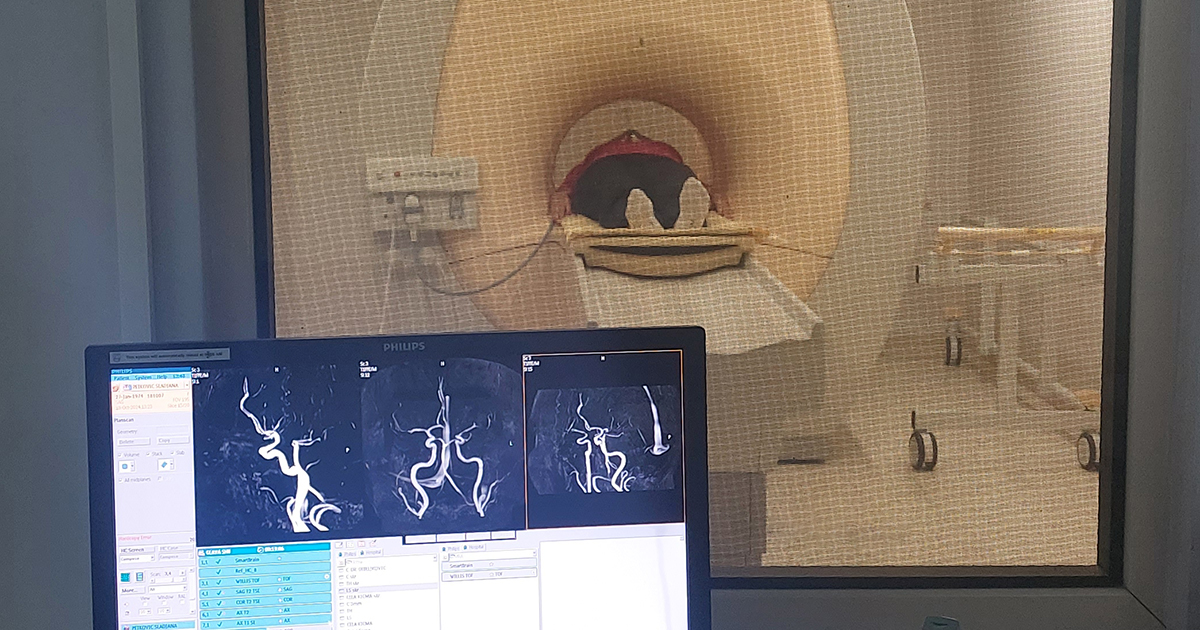 Mr angiografija - snimanje krvnih sudova glave